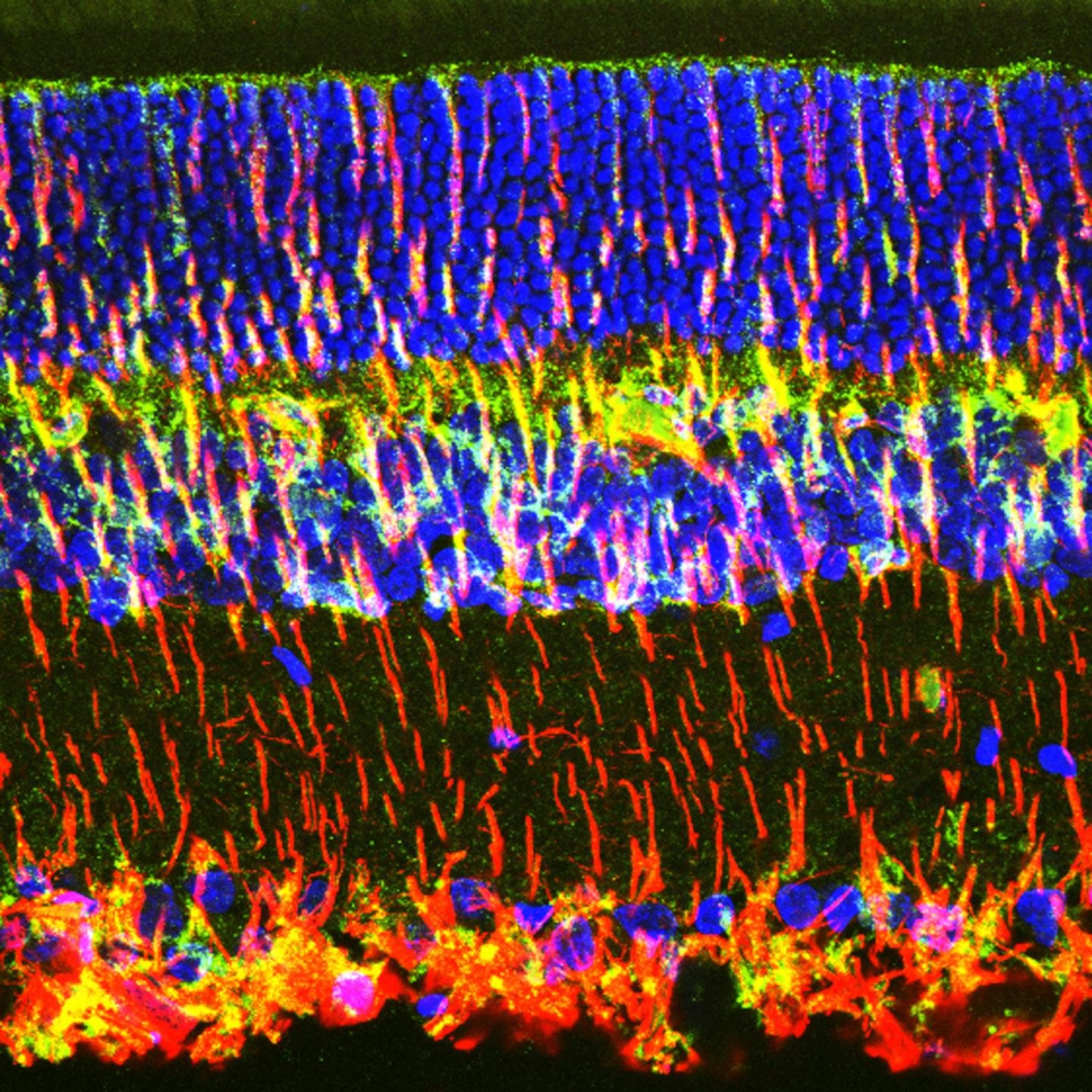 Retinal Cell Layers [IMAGE] | EurekAlert! Science News Releases