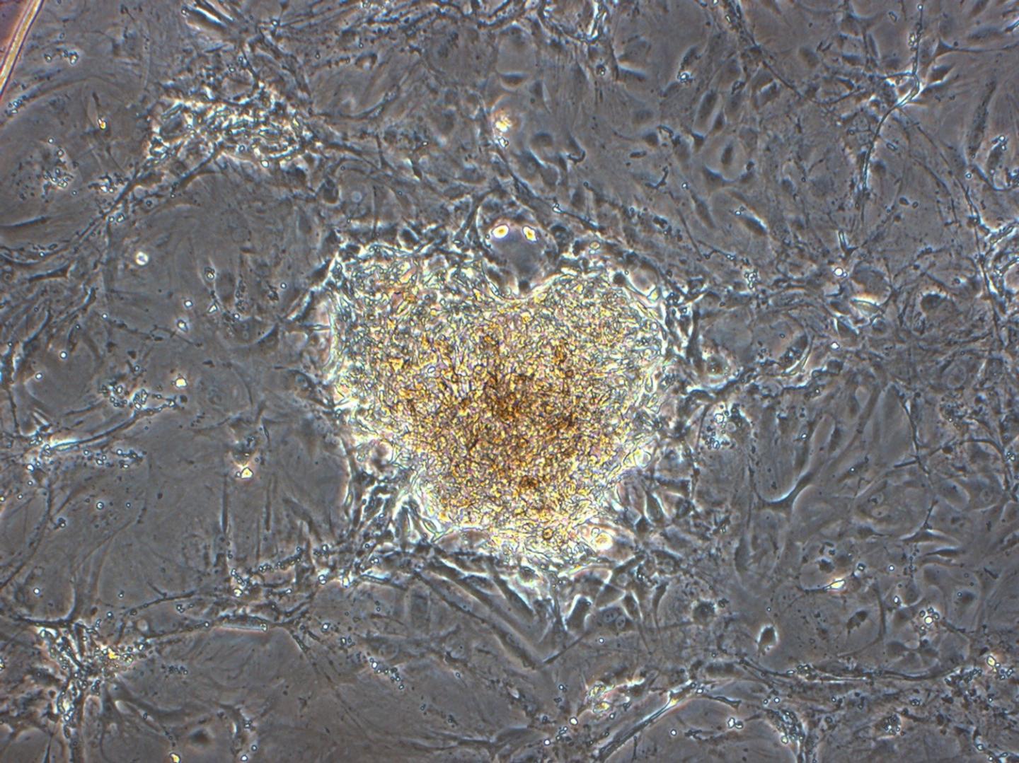 Tasmanian Devil Stem Cell Colo [IMAGE] | EurekAlert! Science News Releases