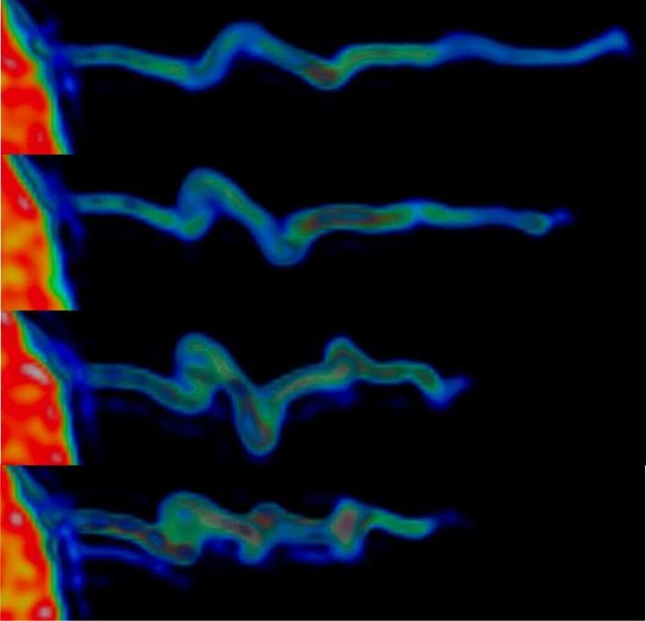 Filopodia [IMAGE] | EurekAlert! Science News Releases