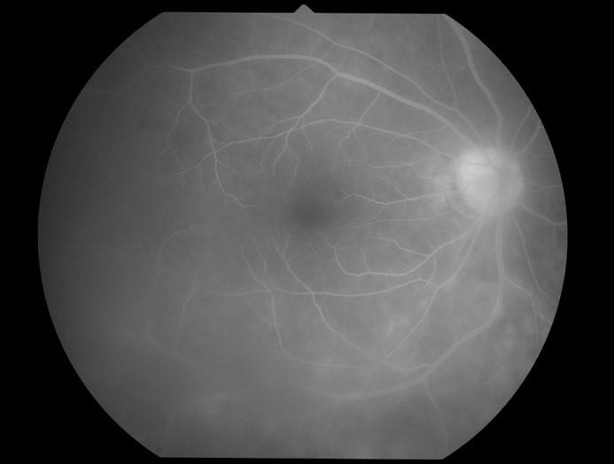Figure2. Imaging of HTLV-1 uve [IMAGE] | EurekAlert! Science News Releases