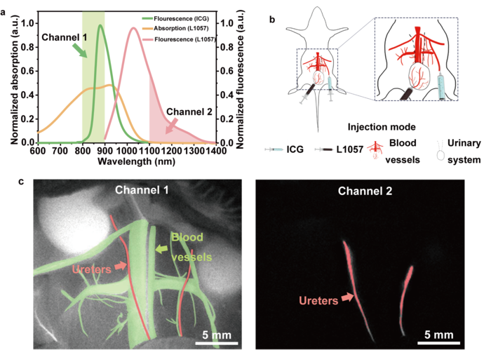 Multi-mode imaging of urinary [IMAGE] | EurekAlert! Science News Releases