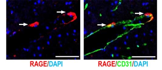 Figure 2. Expression of RAGE i [IMAGE] | EurekAlert! Science News Releases