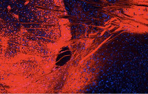 Dynorphin Neurons [IMAGE] | EurekAlert! Science News Releases