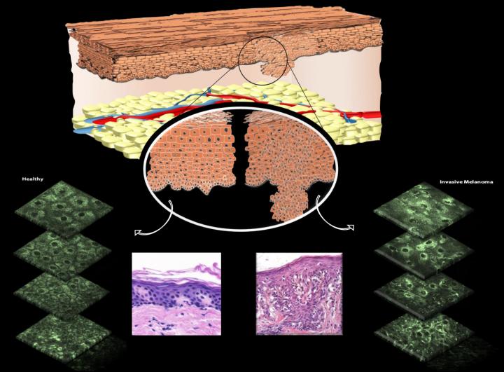 Mitochondrial Imaging Tool Can Detect Skin Ca | EurekAlert!