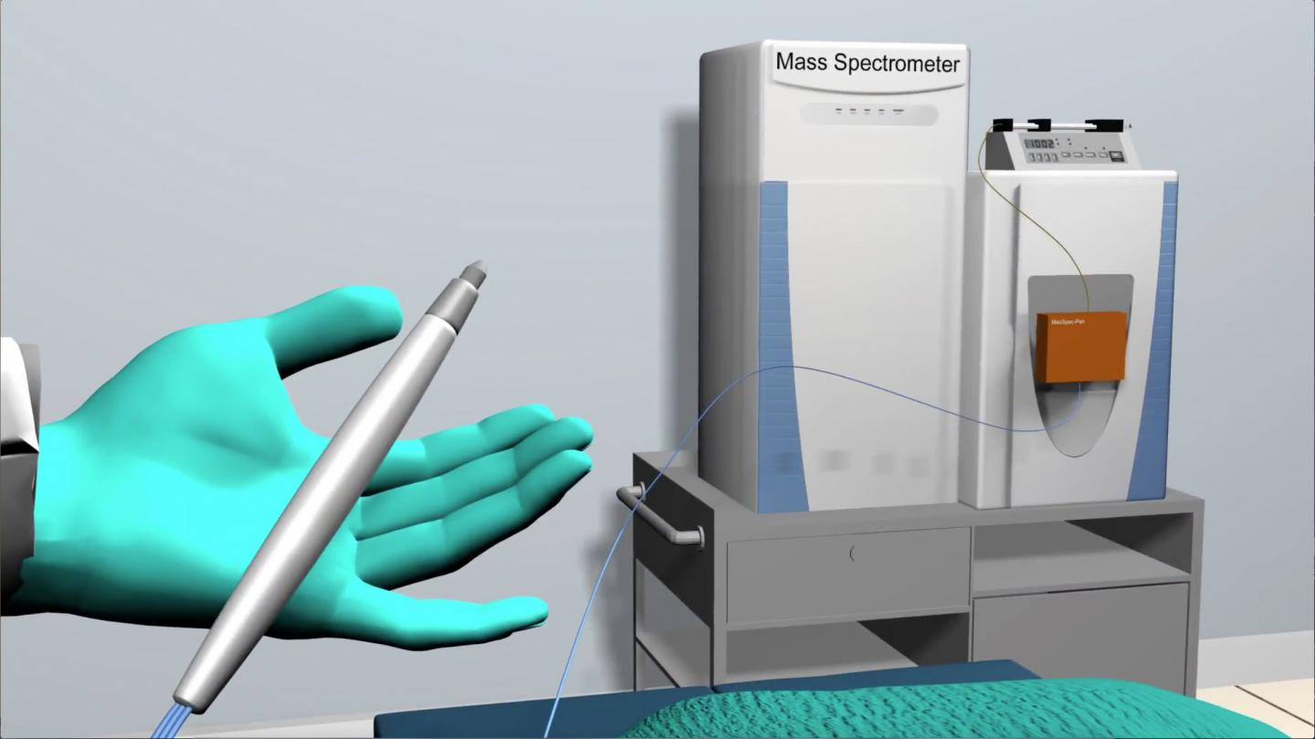 Handheld "Pen" May Bring Real-time Cancer Dia | EurekAlert!