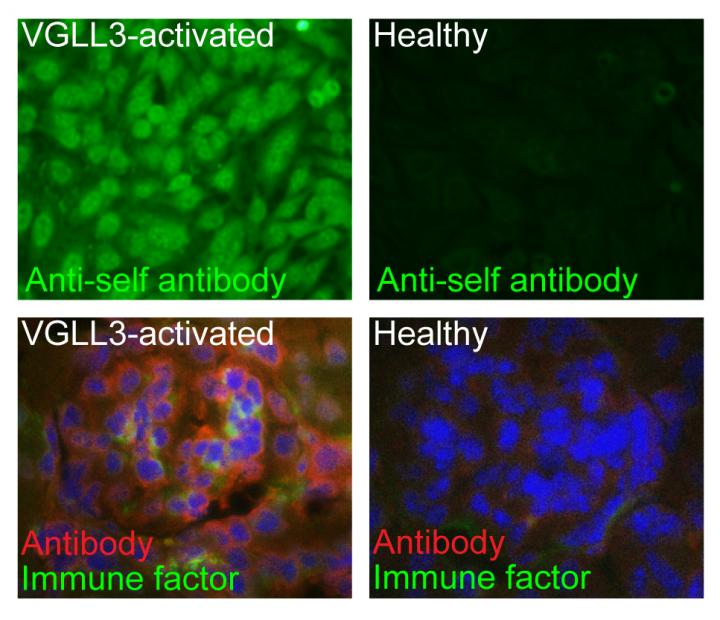 VGLL3 and Autoimmune [IMAGE] | EurekAlert! Science News Releases