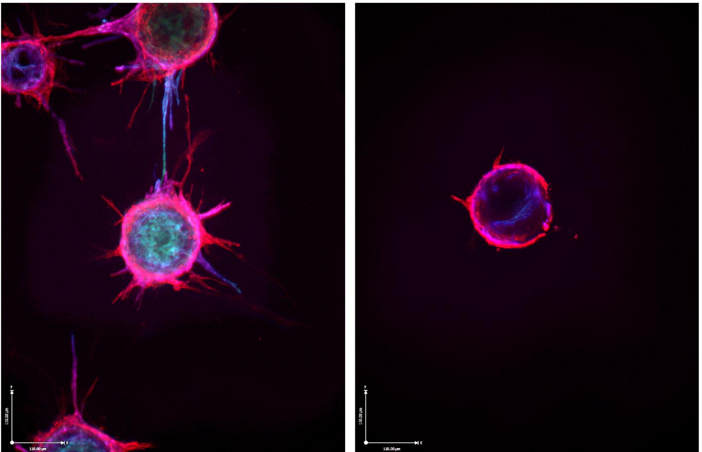 Here's how cancer hijacks wound healing to cr | EurekAlert!