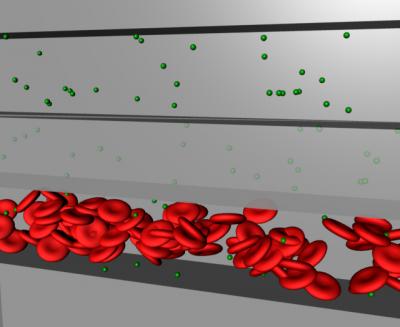 Microfluidic Device Predicts Sickle Cell Dise | EurekAlert!