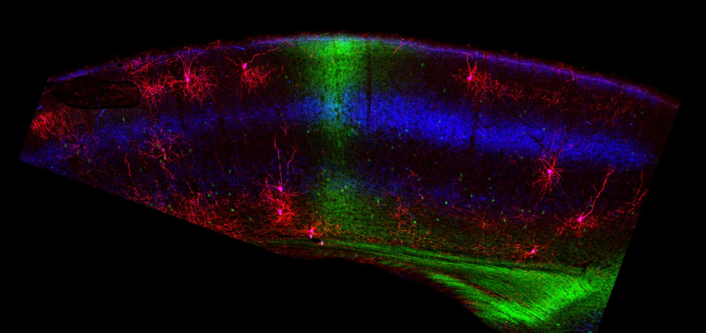 Brain clears the way for binocular vision eve | EurekAlert!