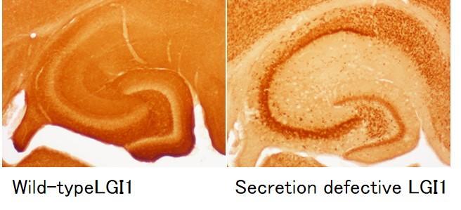 LGI1 Localization [IMAGE] | EurekAlert! Science News Releases