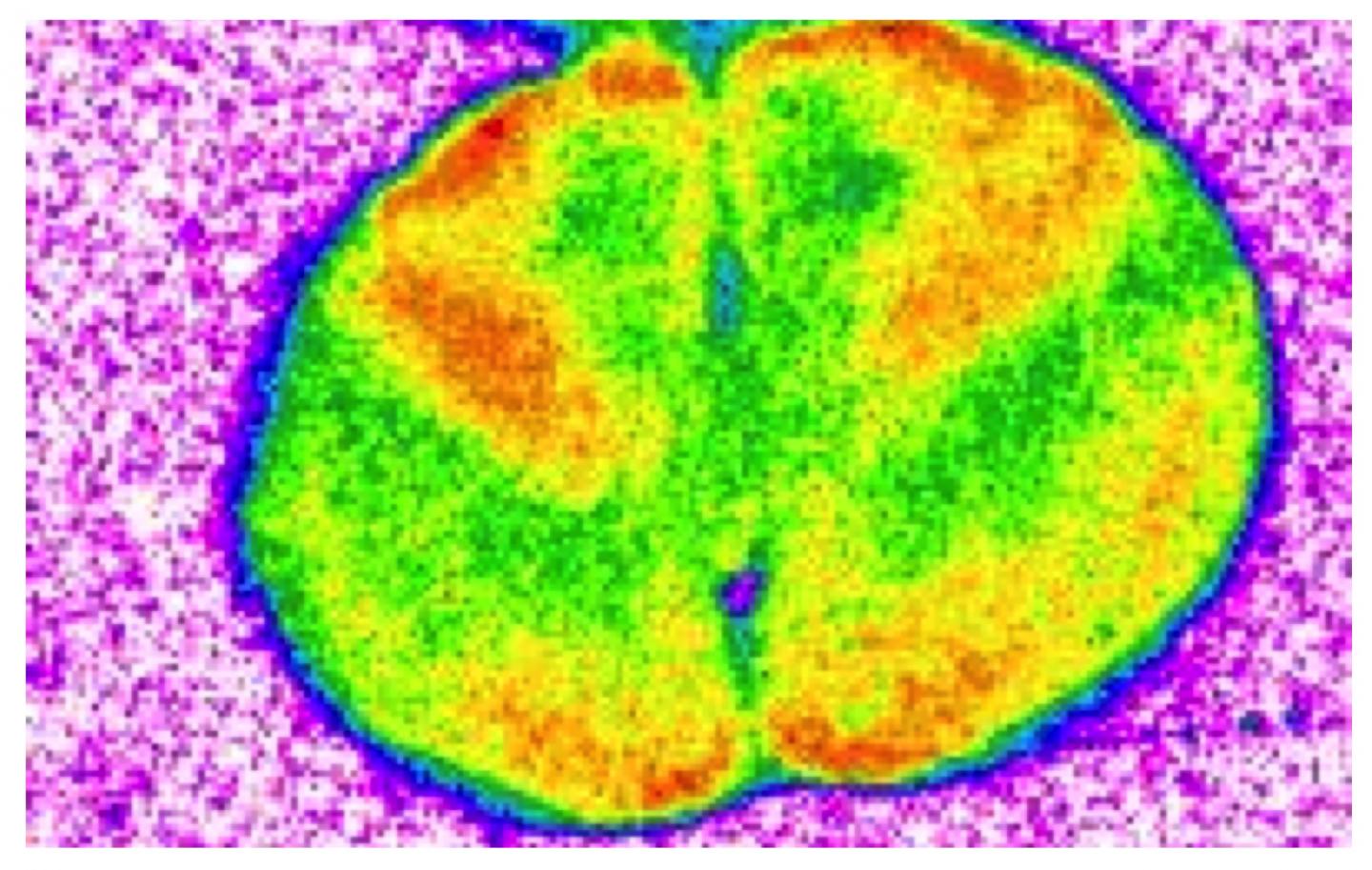 Autoradiogram of the Brain [IMAGE] | EurekAlert! Science News Releases