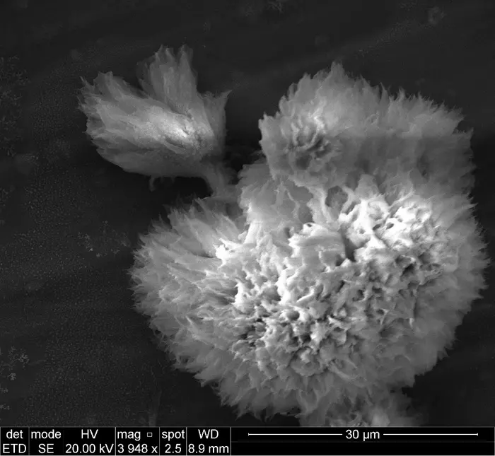 Insulin proteins clumping toge [IMAGE] | EurekAlert! Science News Releases