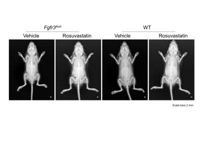Statin Effects on Bone Growth [IMAGE] | EurekAlert! Science News Releases