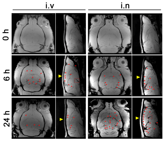 MRI of rat brains after delive [IMAGE] | EurekAlert! Science News Releases