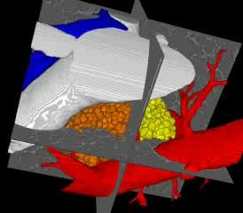 A mammal lung, in 3-D | EurekAlert!