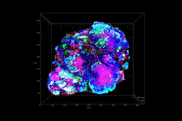 Tumor, Imaged in a Mouse Model [IMAGE] | EurekAlert! Science News Releases