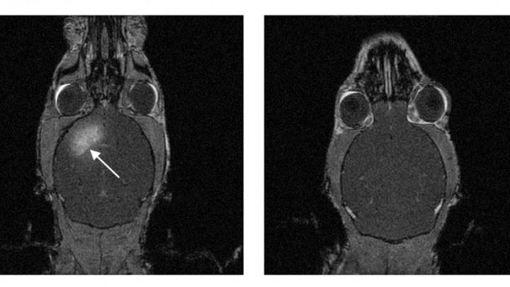 Focused-Ultrasound Enables Tra [IMAGE] | EurekAlert! Science News Releases