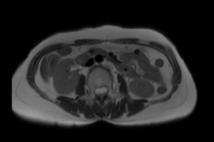 Case Study 1 [IMAGE] | EurekAlert! Science News Releases