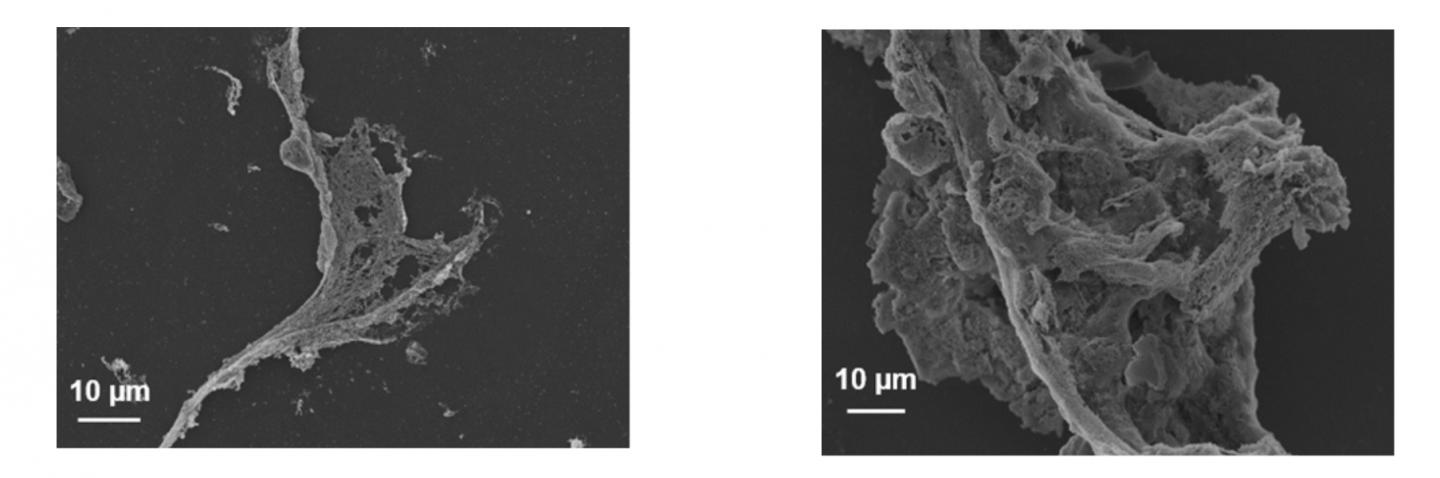 Mucus Accumulation Precedes Dangerous Lung In | EurekAlert!