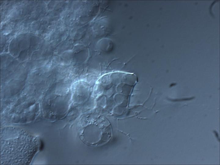 Chytrid Fungus [IMAGE] | EurekAlert! Science News Releases