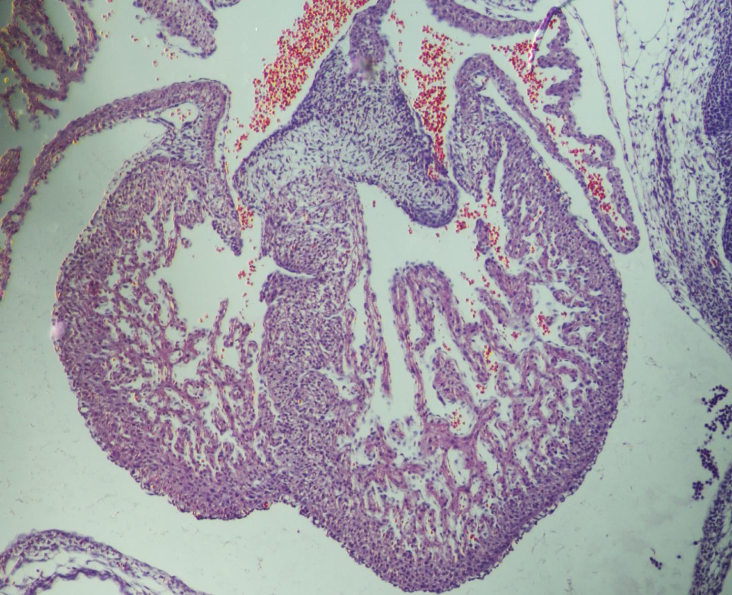 Developing Mouse Heart [IMAGE] | EurekAlert! Science News Releases
