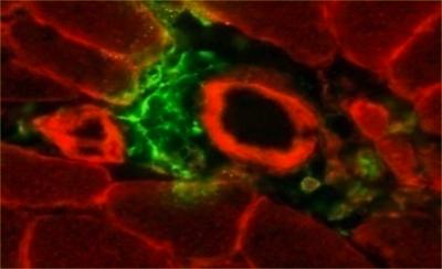 Mesenchymal Stem Cells in Musc [IMAGE] | EurekAlert! Science News Releases