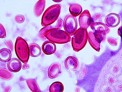 Parasitic Worms May Soothe Intestine (1 of 6) | EurekAlert!