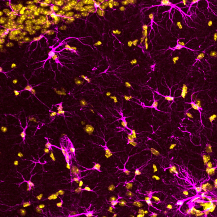 Astrocytes [IMAGE] | EurekAlert! Science News Releases
