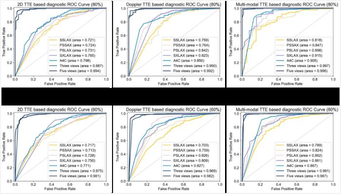 Fig. 1. ROC curves of classifi [IMAGE] | EurekAlert! Science News Releases