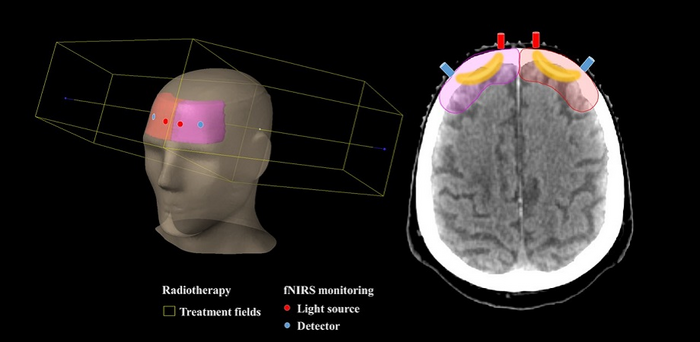 Measuring changes in brain tissue oxygenation | EurekAlert!