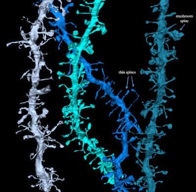 Dendrite [IMAGE] | EurekAlert! Science News Releases