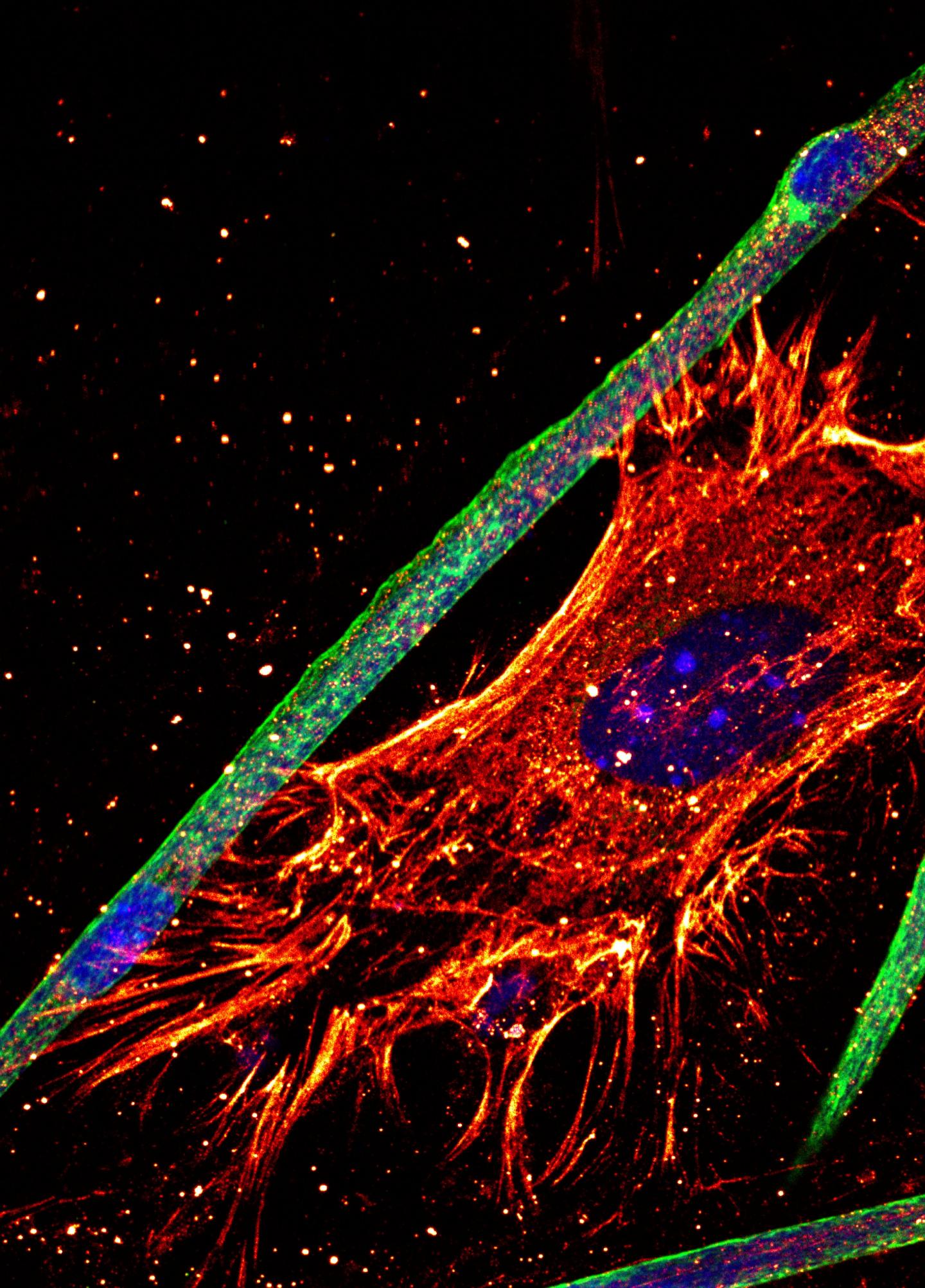 Muscle and Myofibroblast [IMAGE] | EurekAlert! Science News Releases
