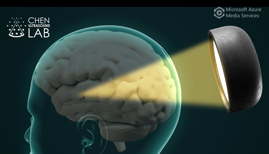 Induction of a torpor-like state with ultraso | EurekAlert!