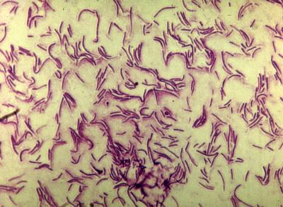 How Beetles Keep Bacteria in Check (12 of 15) | EurekAlert!