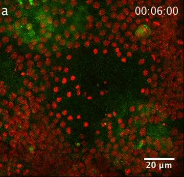 Watch fat cells help heal a wound in a fly | EurekAlert!