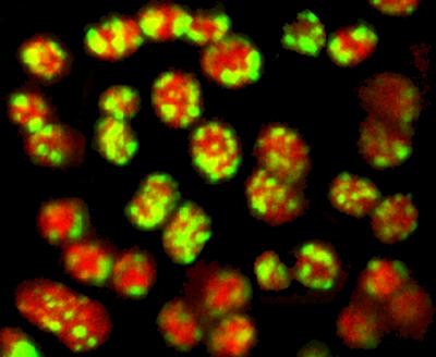 Chloroplasts Under the Microsc [IMAGE] | EurekAlert! Science News Releases