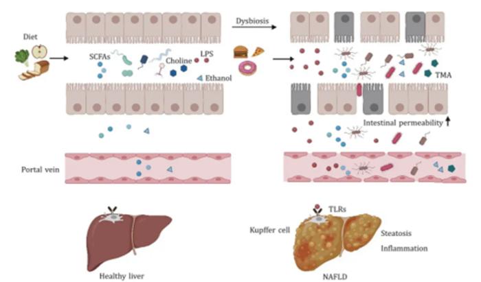 Understanding how gut bacteria affect chronic | EurekAlert!