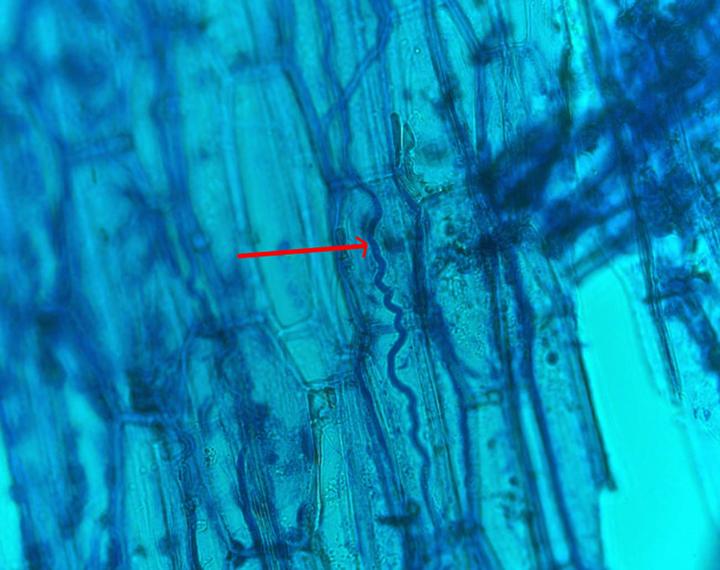 Epichloë hypha [IMAGE] | EurekAlert! Science News Releases