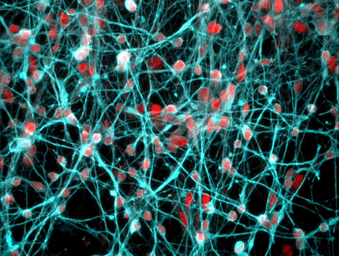 Human Brain Cells Under A Microscope