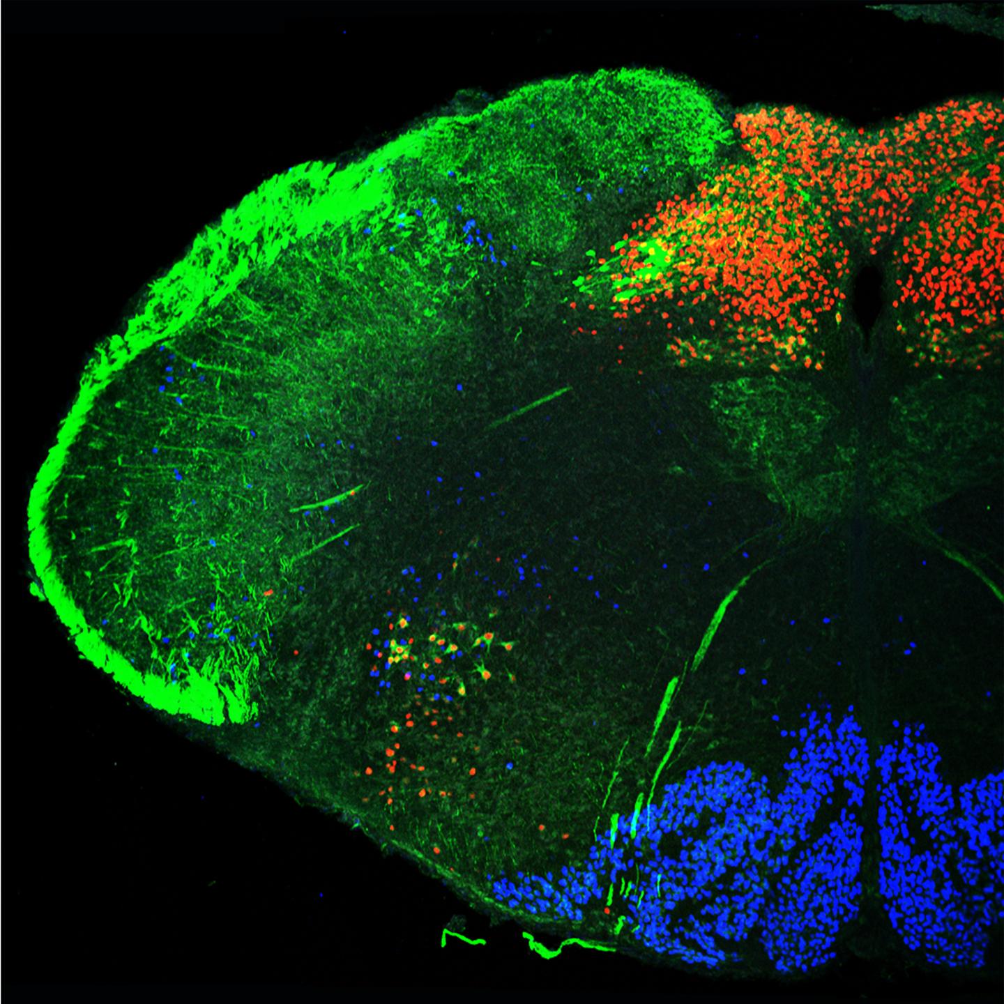 Hindbrain of a Mouse [IMAGE] | EurekAlert! Science News Releases
