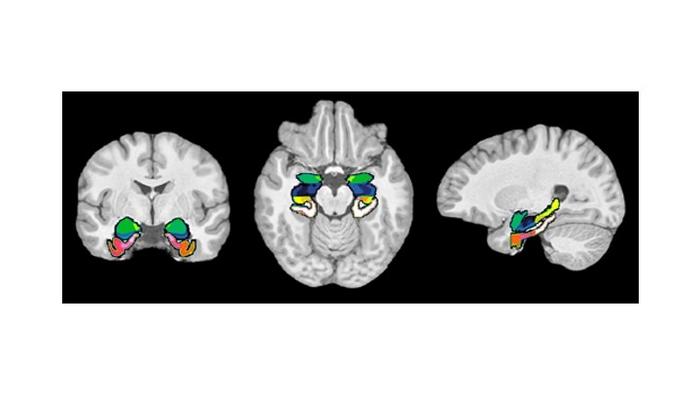 scan [IMAGE] | EurekAlert! Science News Releases