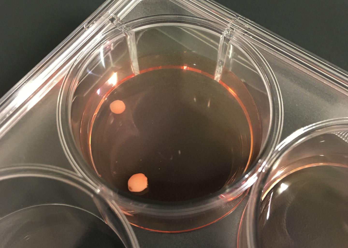 Mini Brain Culture [IMAGE] | EurekAlert! Science News Releases