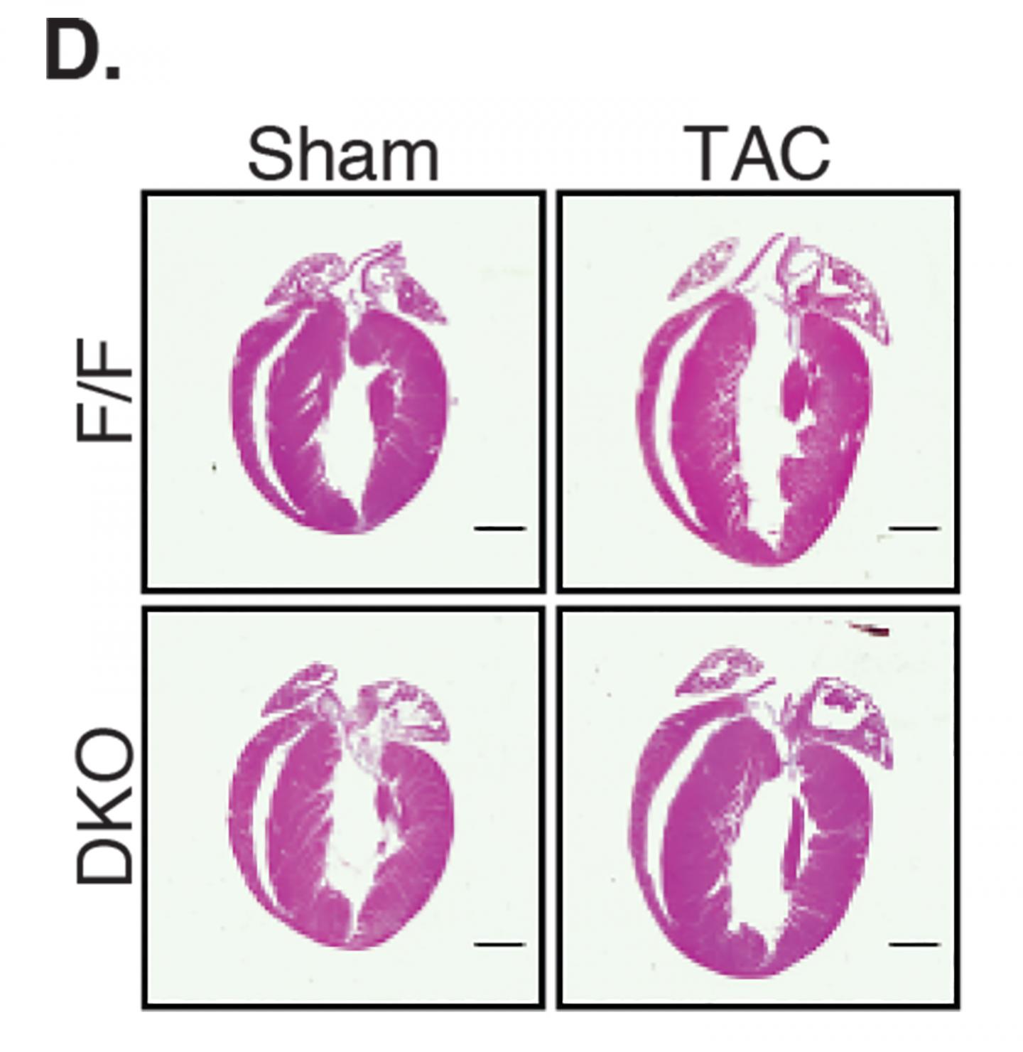 Cancer Drug May Help Prevent Heart Failure | EurekAlert!