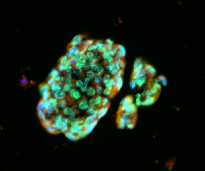 Lung Spheroid Cell [IMAGE] | EurekAlert! Science News Releases