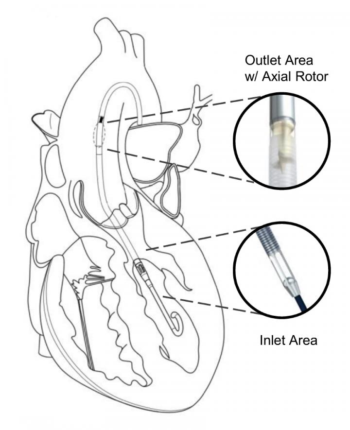 Implantable Machines Measure Heart Function ( | EurekAlert!