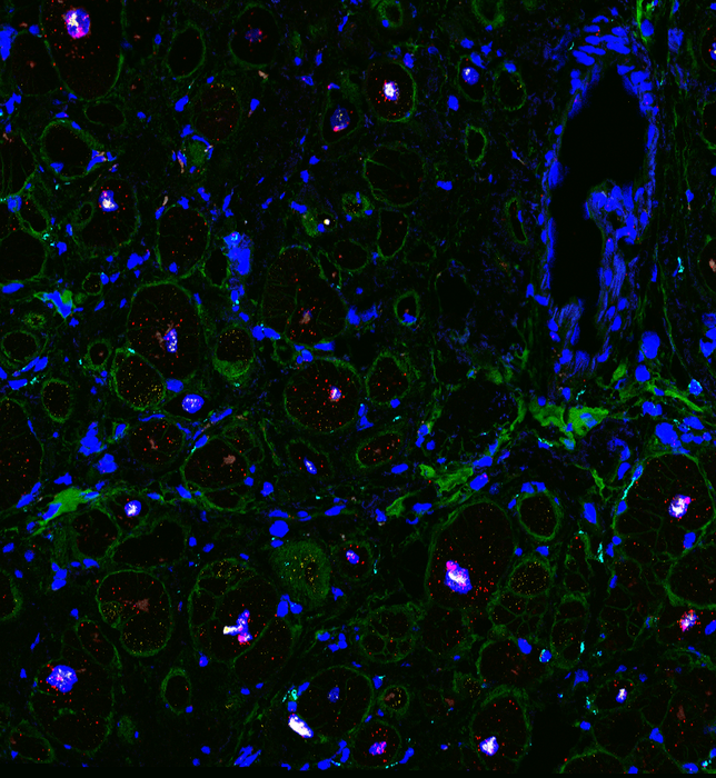 Cellular landscape of cardiac [IMAGE] | EurekAlert! Science News Releases