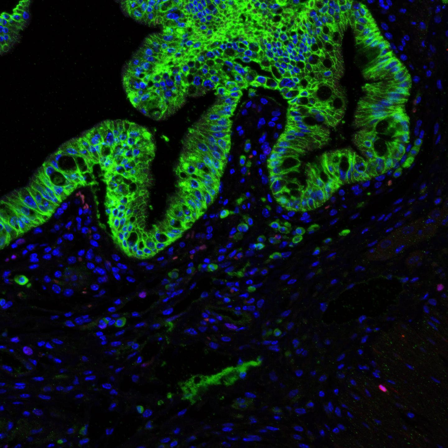 Colon of a Mouse Without Stem [IMAGE] | EurekAlert! Science News Releases