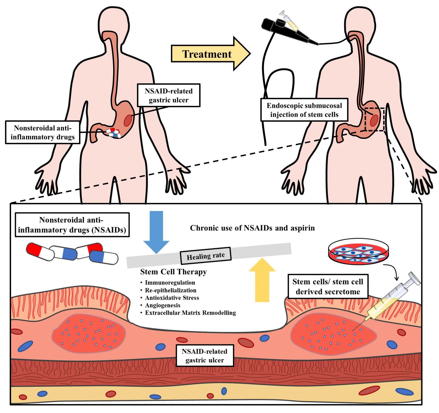 Stem Cell Treatment Accelerates Healing of Dr | EurekAlert!