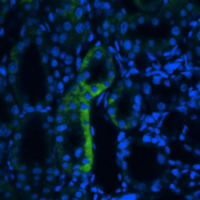 Genetically modified cell procedure may prove | EurekAlert!