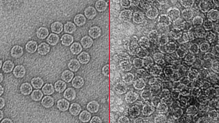 Virus [IMAGE] | EurekAlert! Science News Releases